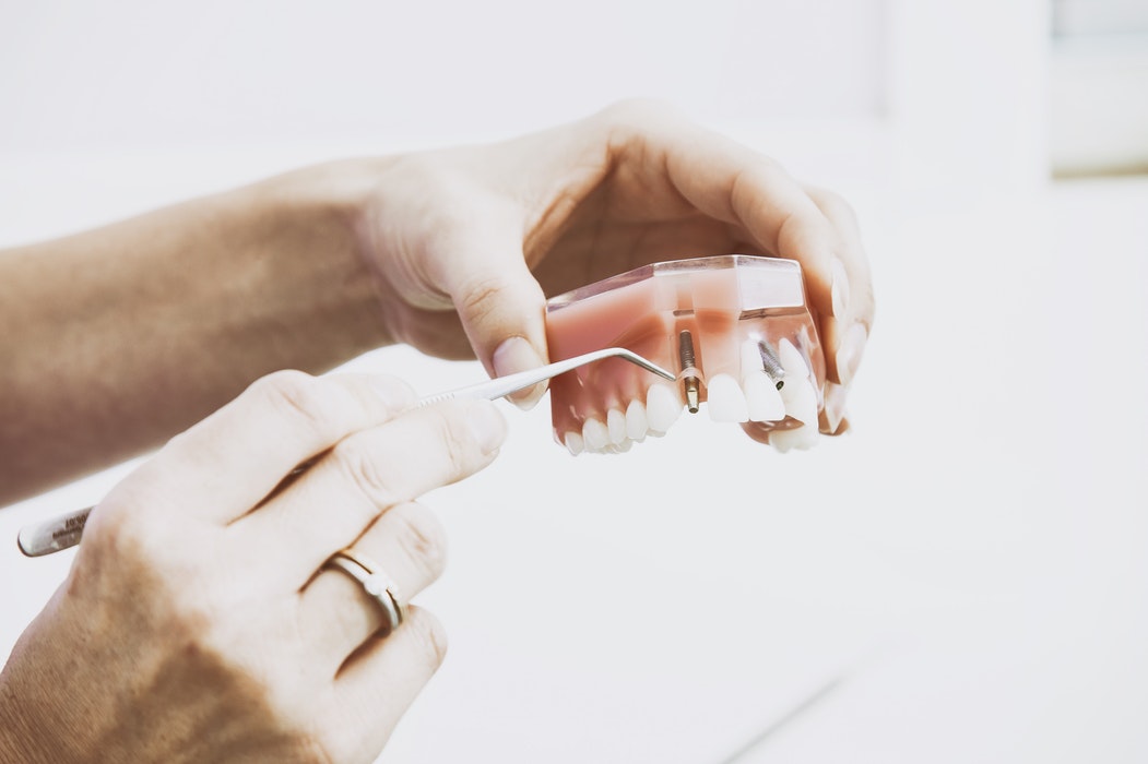 How Are Dentures Made - Expert Denture Clinic - Winnipeg MB